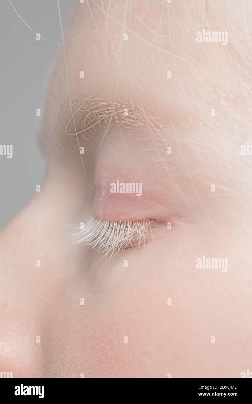 Brow and eyelid. Close up portrait of beautiful albino female model ...