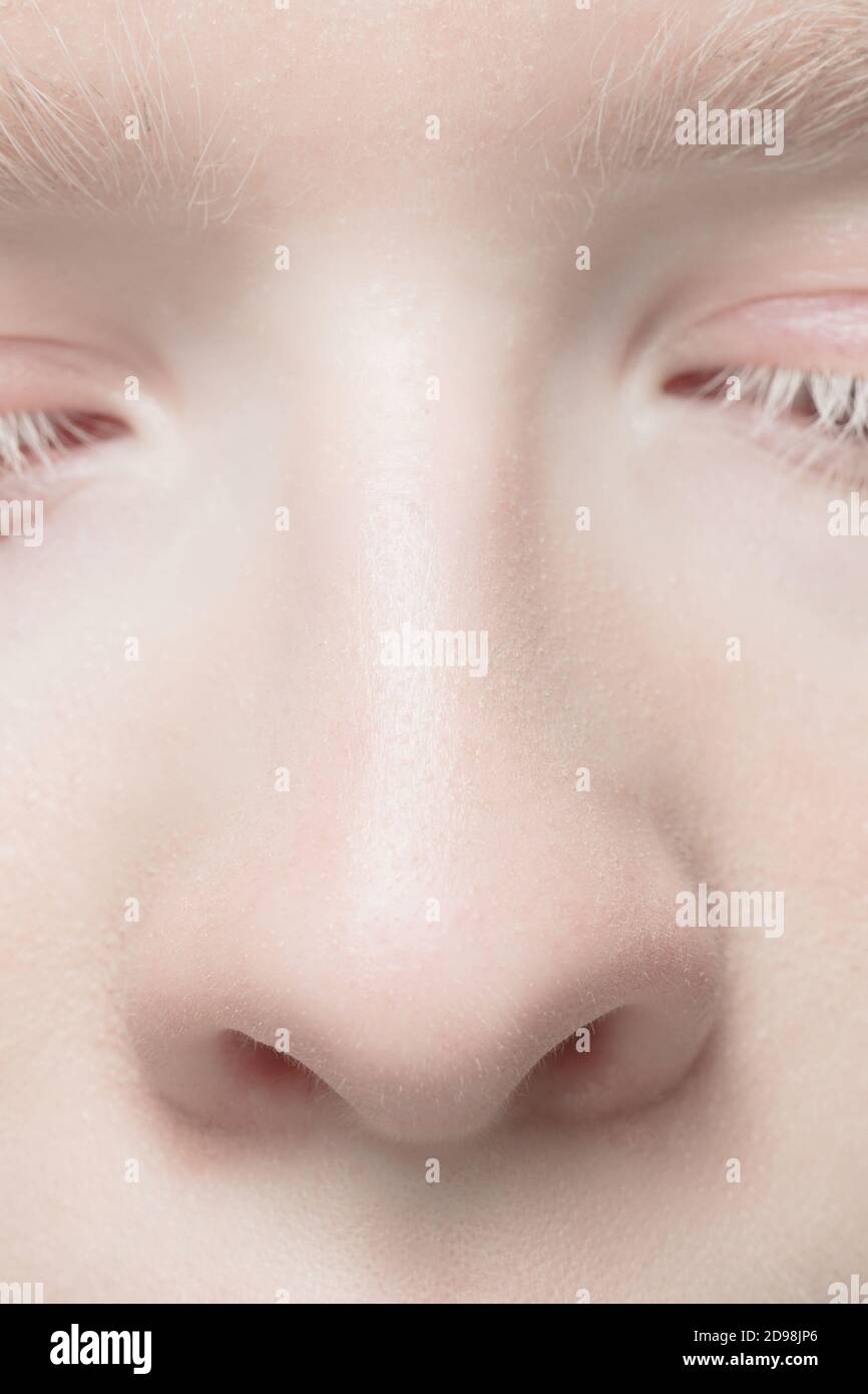 Nose and eyelid. Close up portrait of beautiful albino female model ...