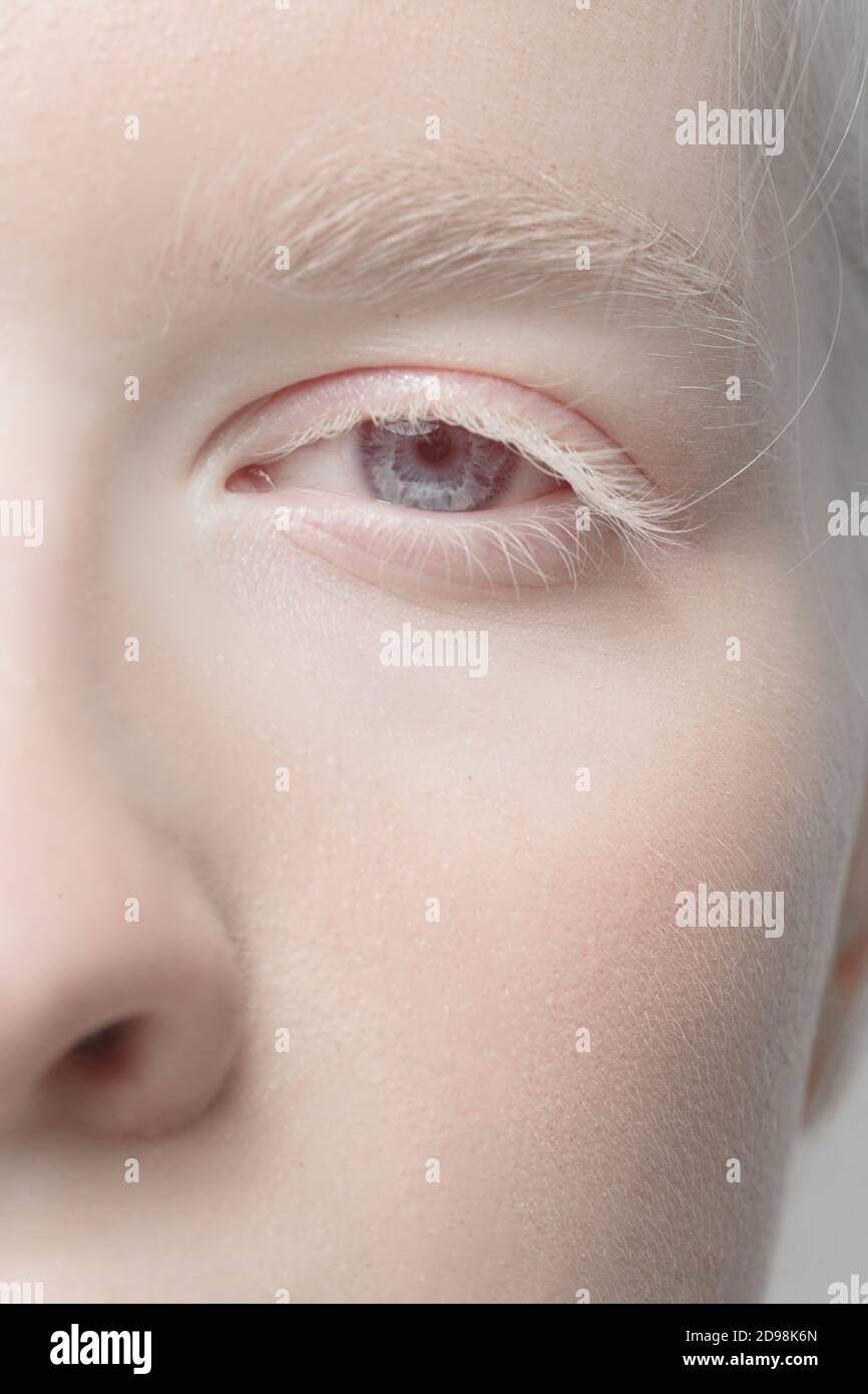 Nose and eyelid. Close up portrait of beautiful albino female model ...