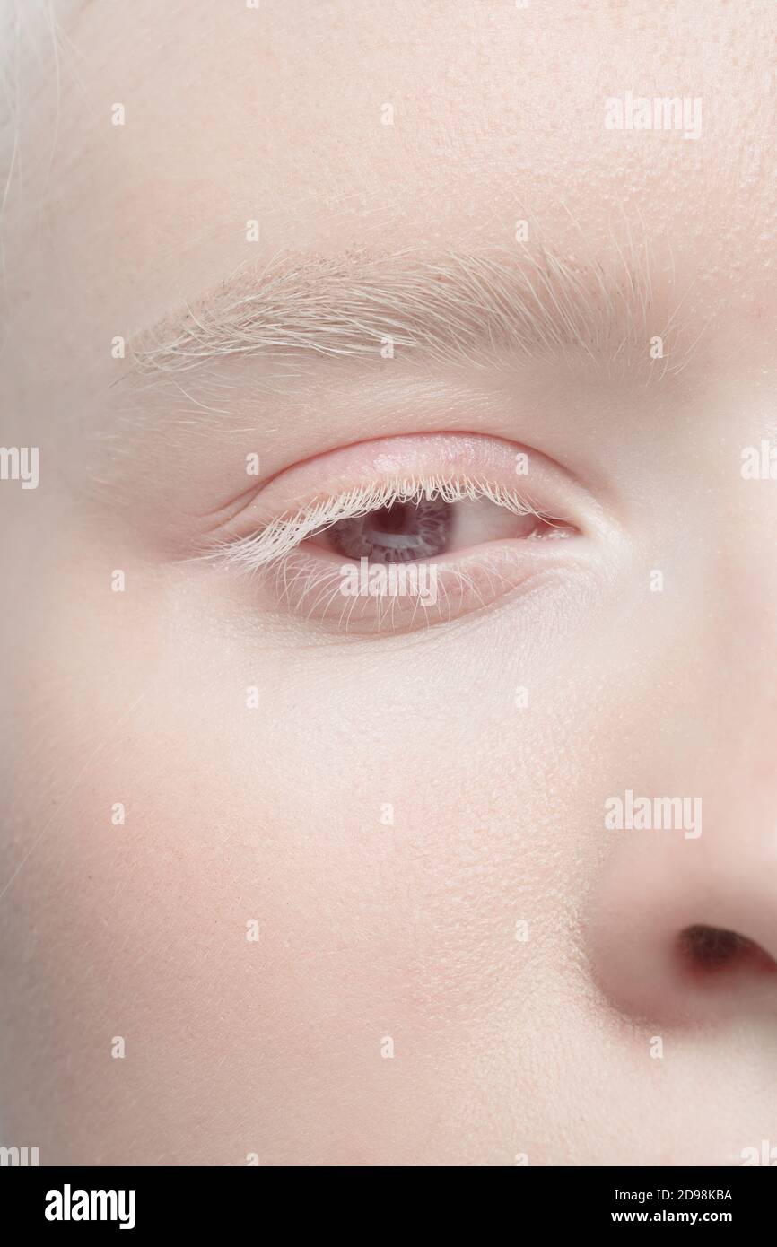 Nose and eyelid. Close up portrait of beautiful albino female model ...