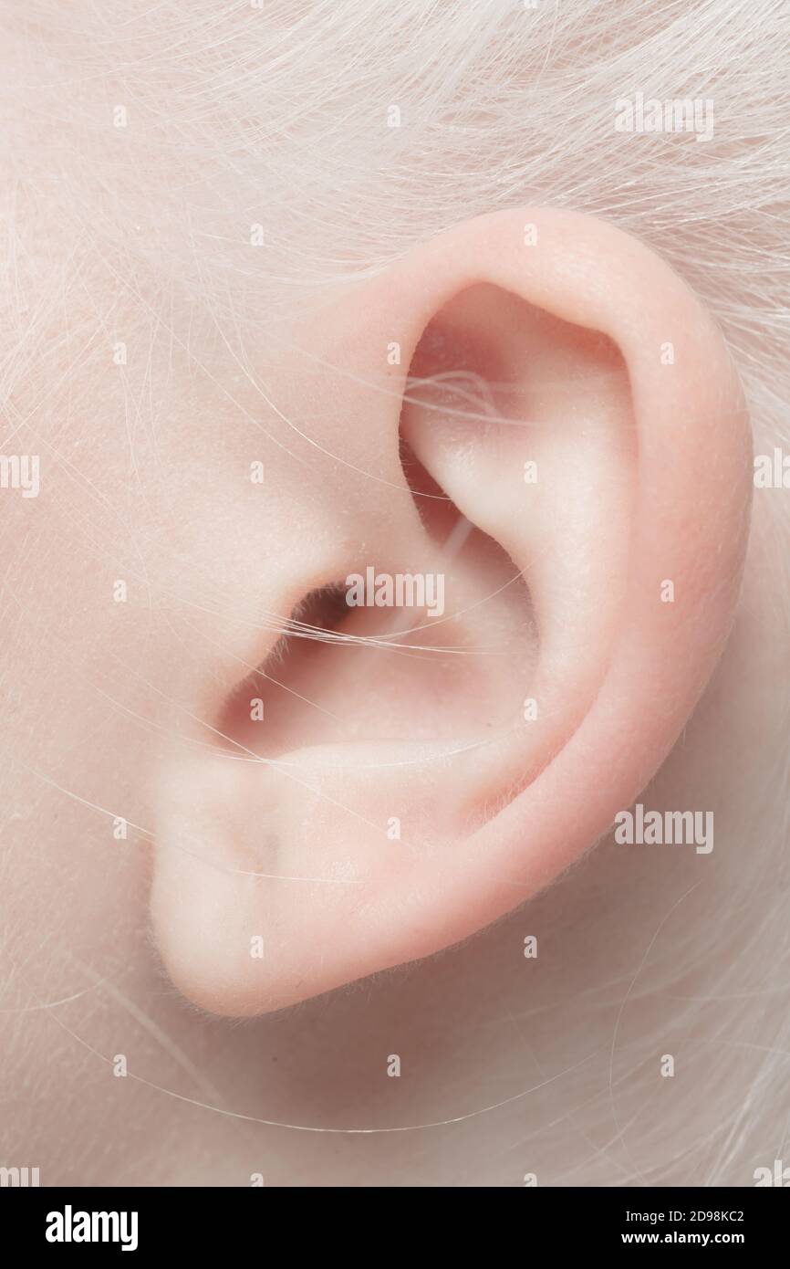 Albino body parts hi-res stock photography and images - Alamy