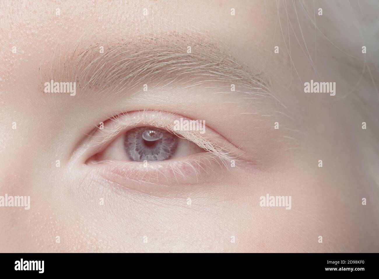 Brow and eyelid. Close up portrait of beautiful albino female model ...