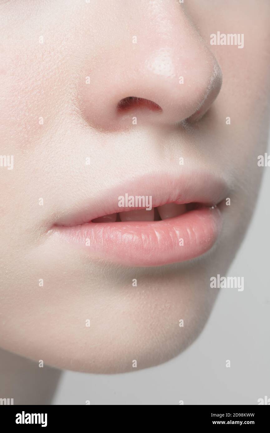 Lips and teeth. Close up portrait of beautiful albino female model ...