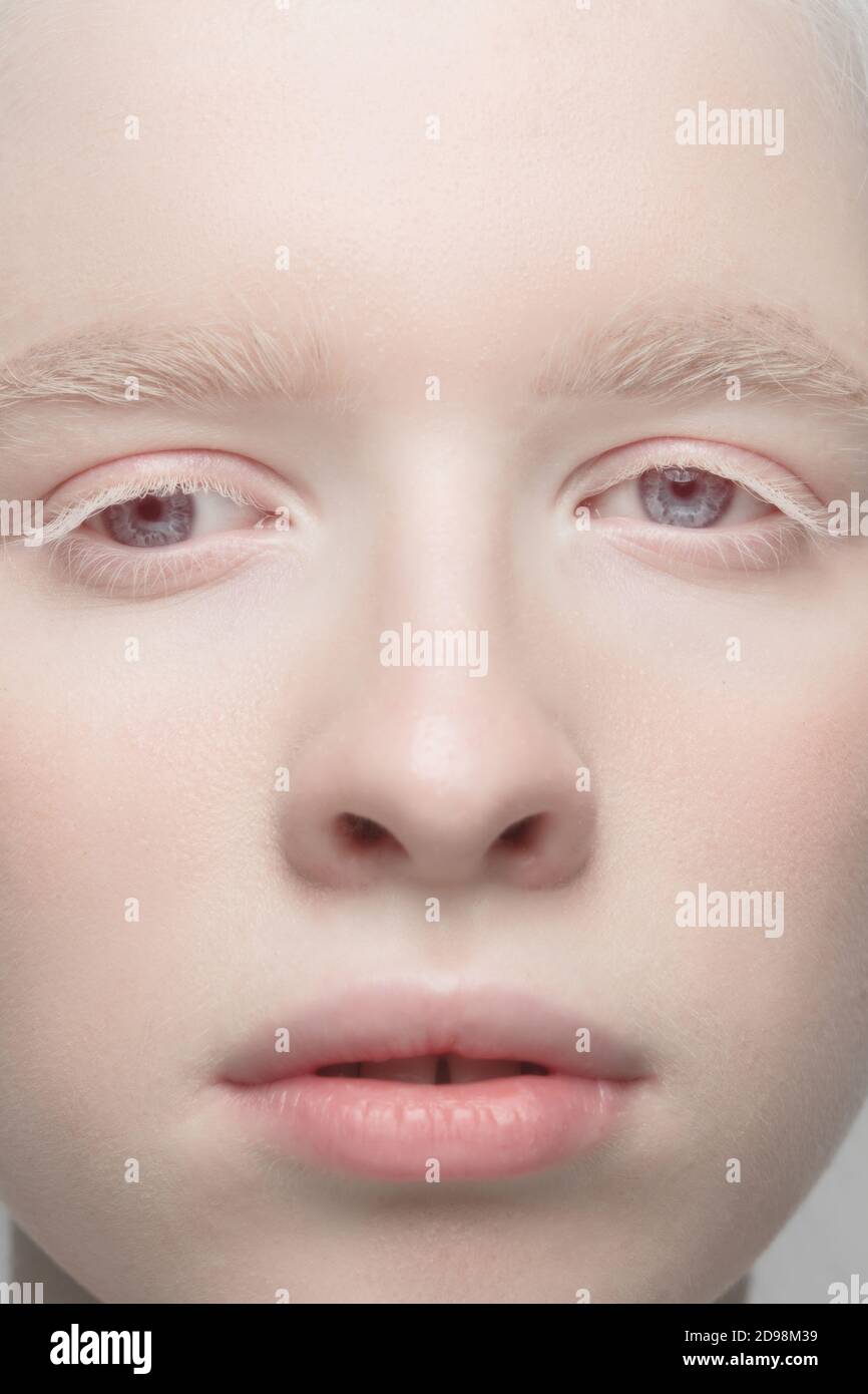Eyes open. Close up portrait of beautiful albino female model. Parts of ...