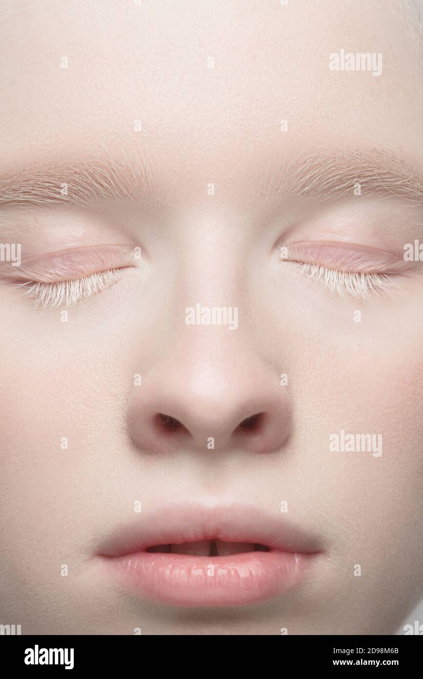 Eyes closed. Close up portrait of beautiful albino female model. Parts ...