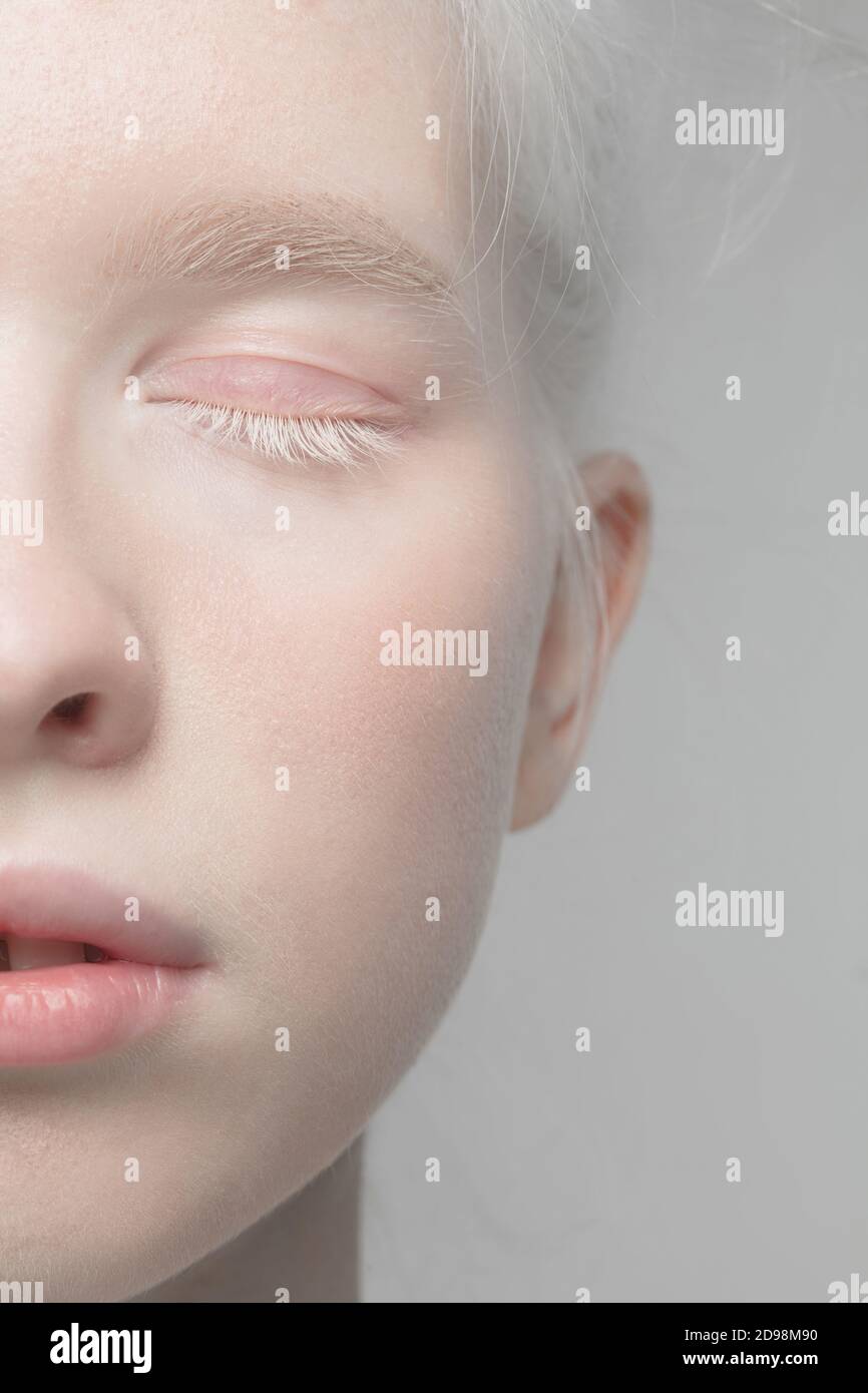Eyes closed. Close up portrait of beautiful albino female model. Parts ...