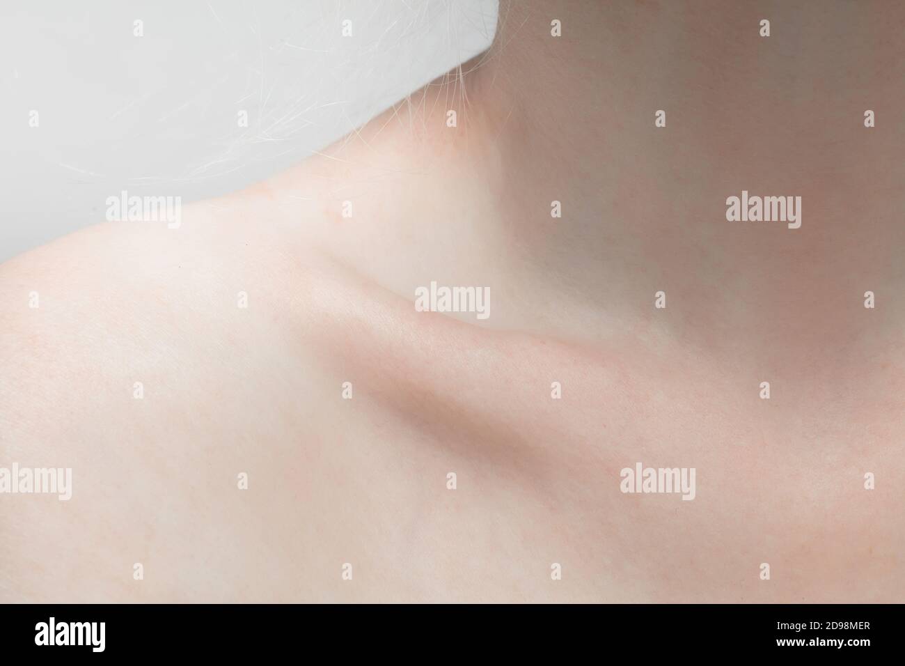 Albino body parts hi-res stock photography and images - Alamy