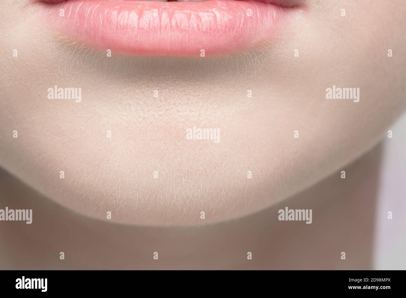 Lips and teeth. Close up portrait of beautiful albino female model ...