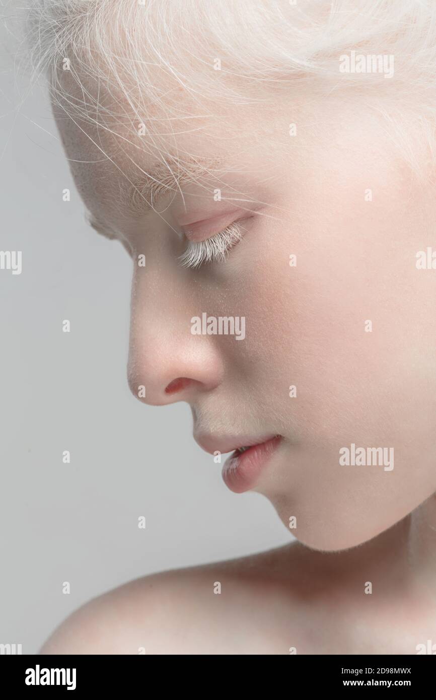 Profile. Close up portrait of beautiful albino female model. Parts of ...