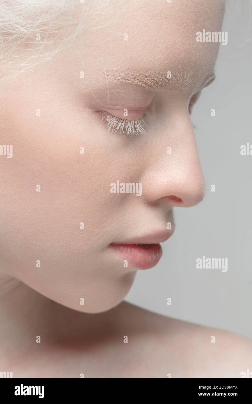 Profile. Close up portrait of beautiful albino female model. Parts of ...