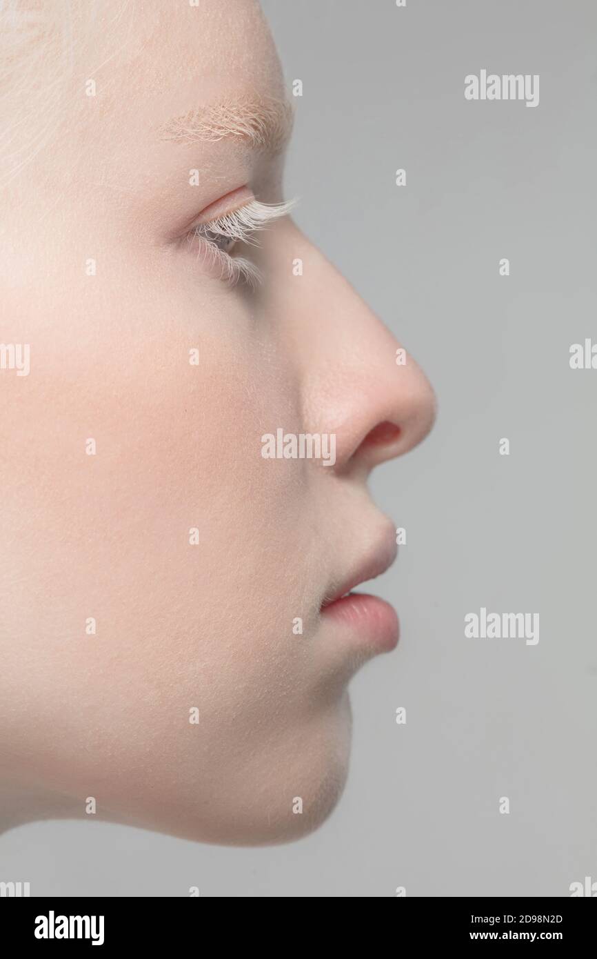 Profile. Close up portrait of beautiful albino female model. Parts of ...