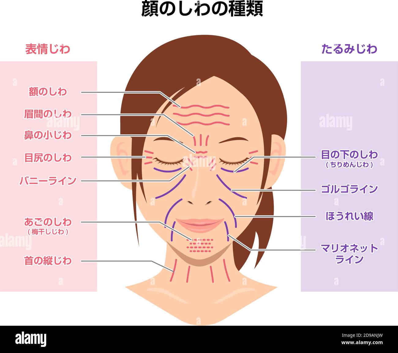 Expression wrinkles and Aging wrinkles ( female face ) vector ...