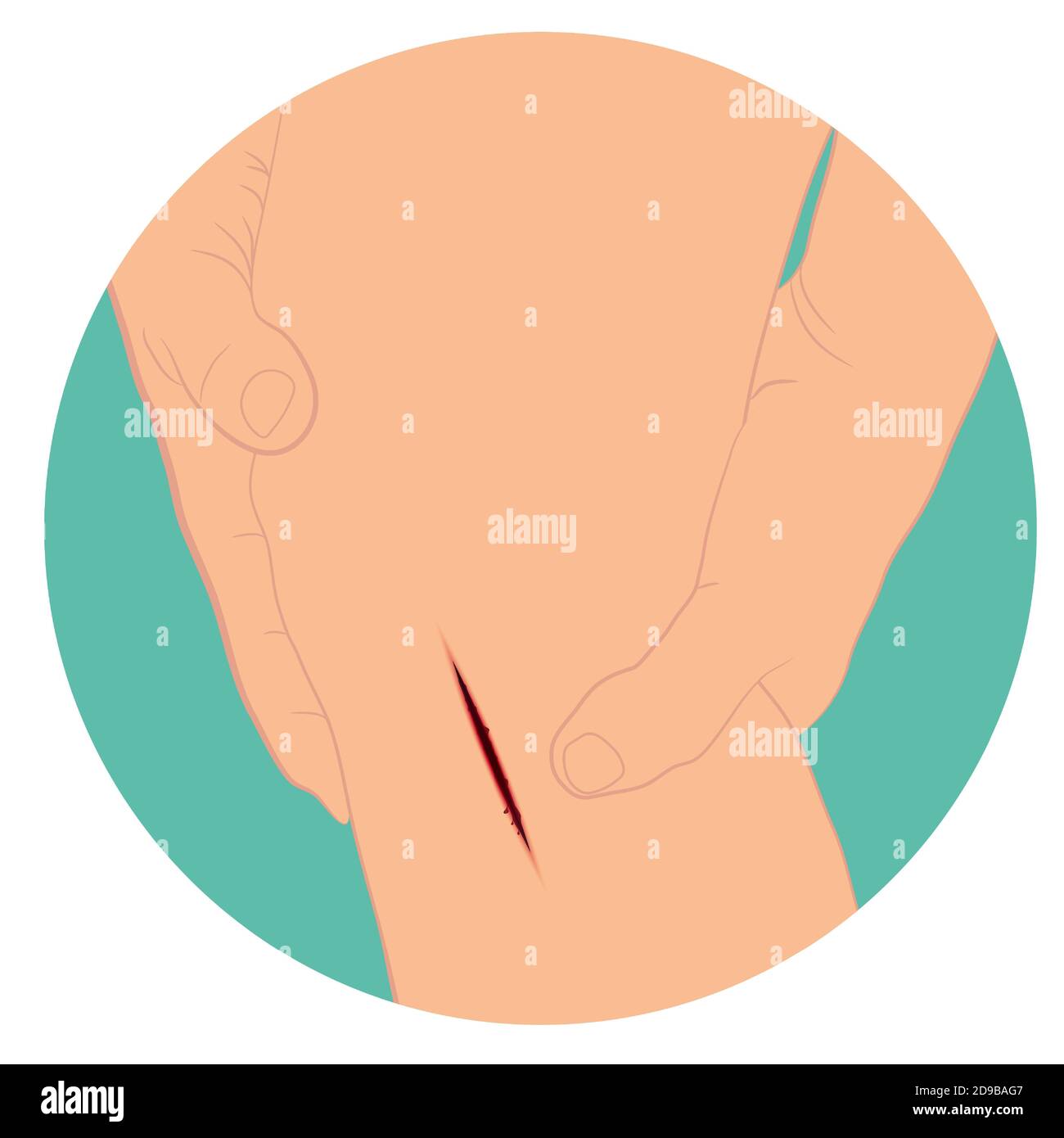 injured leg with bleeding gash with wound on the leg vector ...