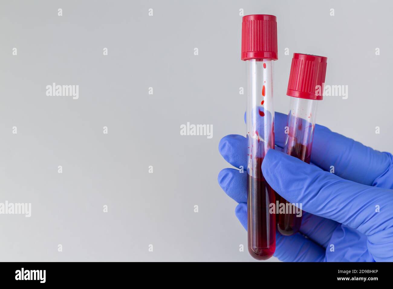 Doctor holding test tubes with red blood ready for testing. Space for ...