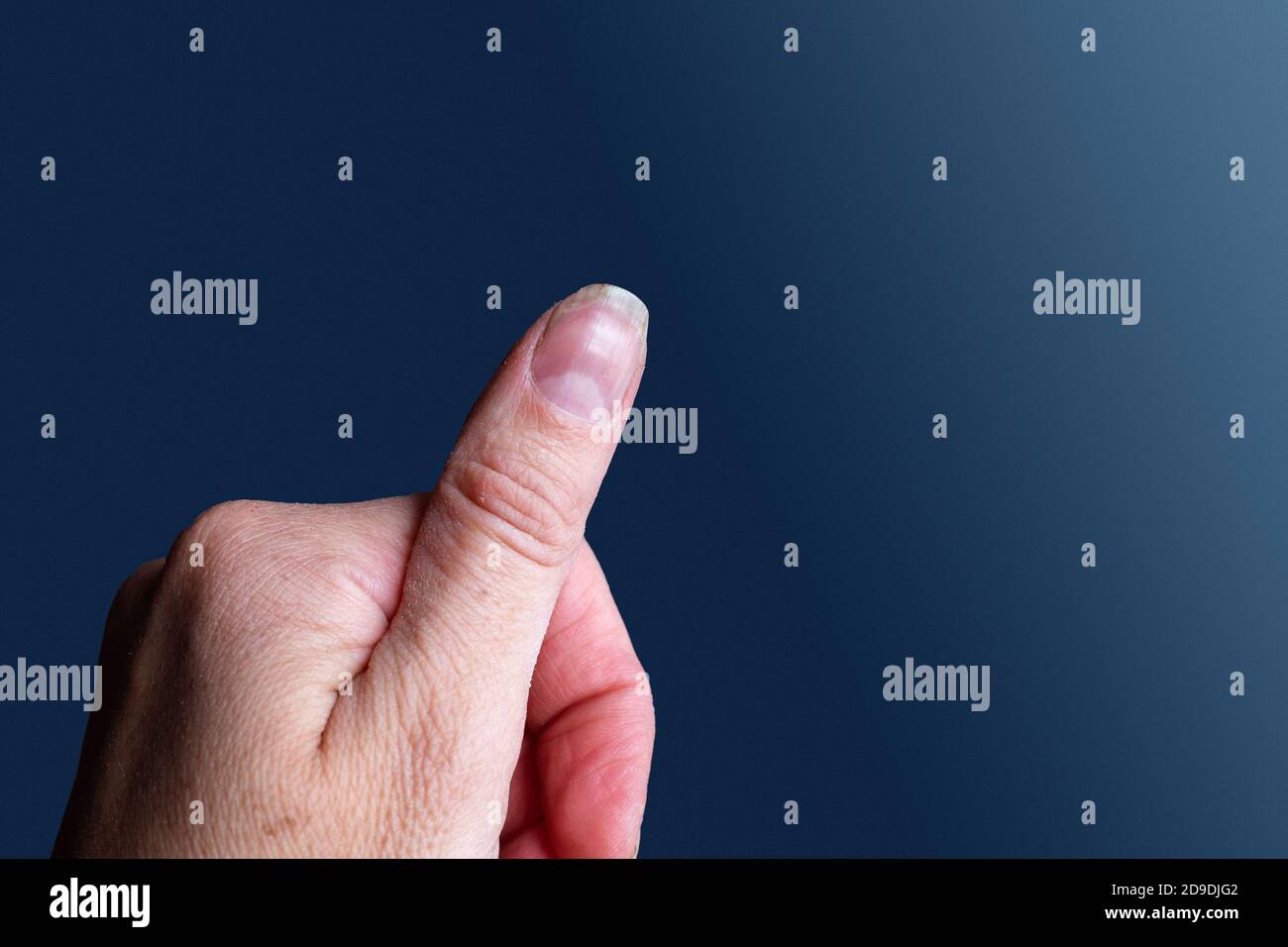 Cut finger hospital hi-res stock photography and images - Alamy