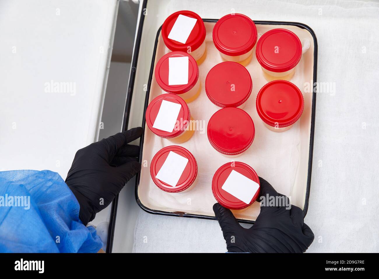 Urine analysis in the laboratory. Medical urine test. Urine sample for ...