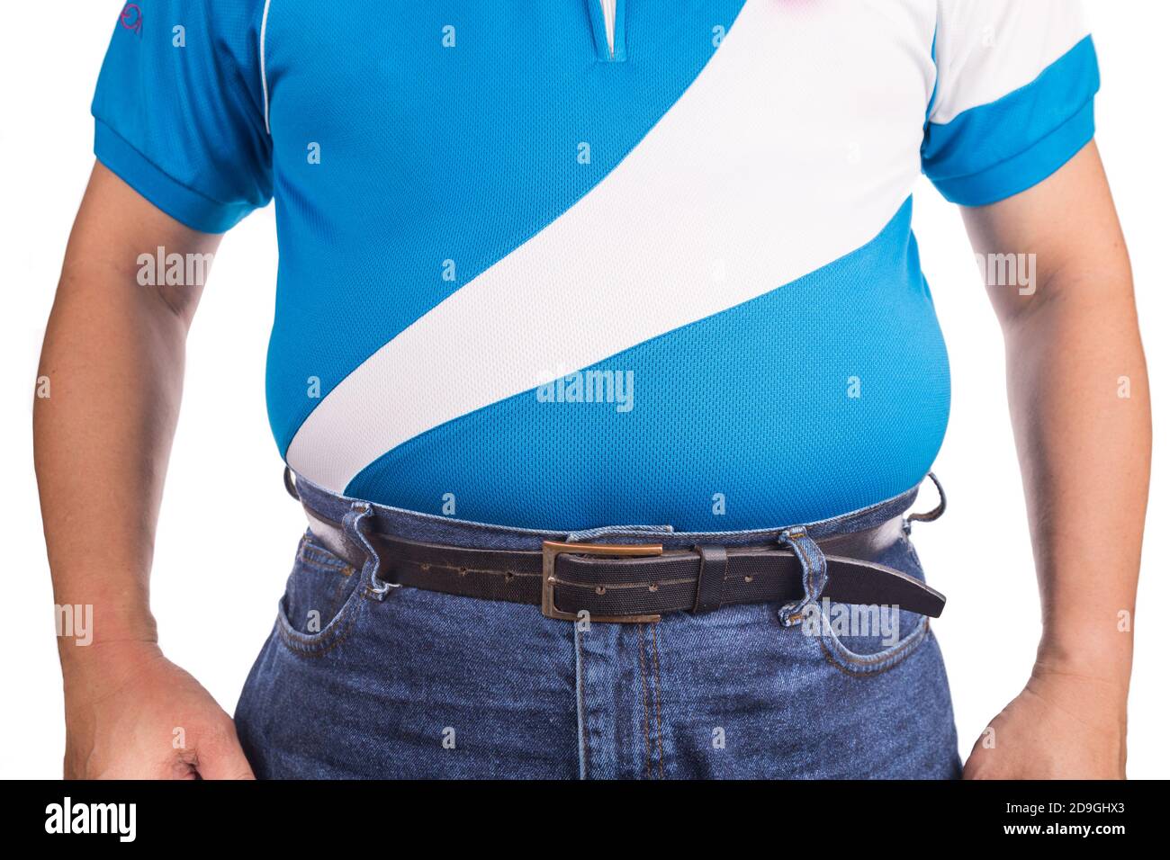 Subcutaneous Fat High Resolution Stock Photography and Images - Alamy