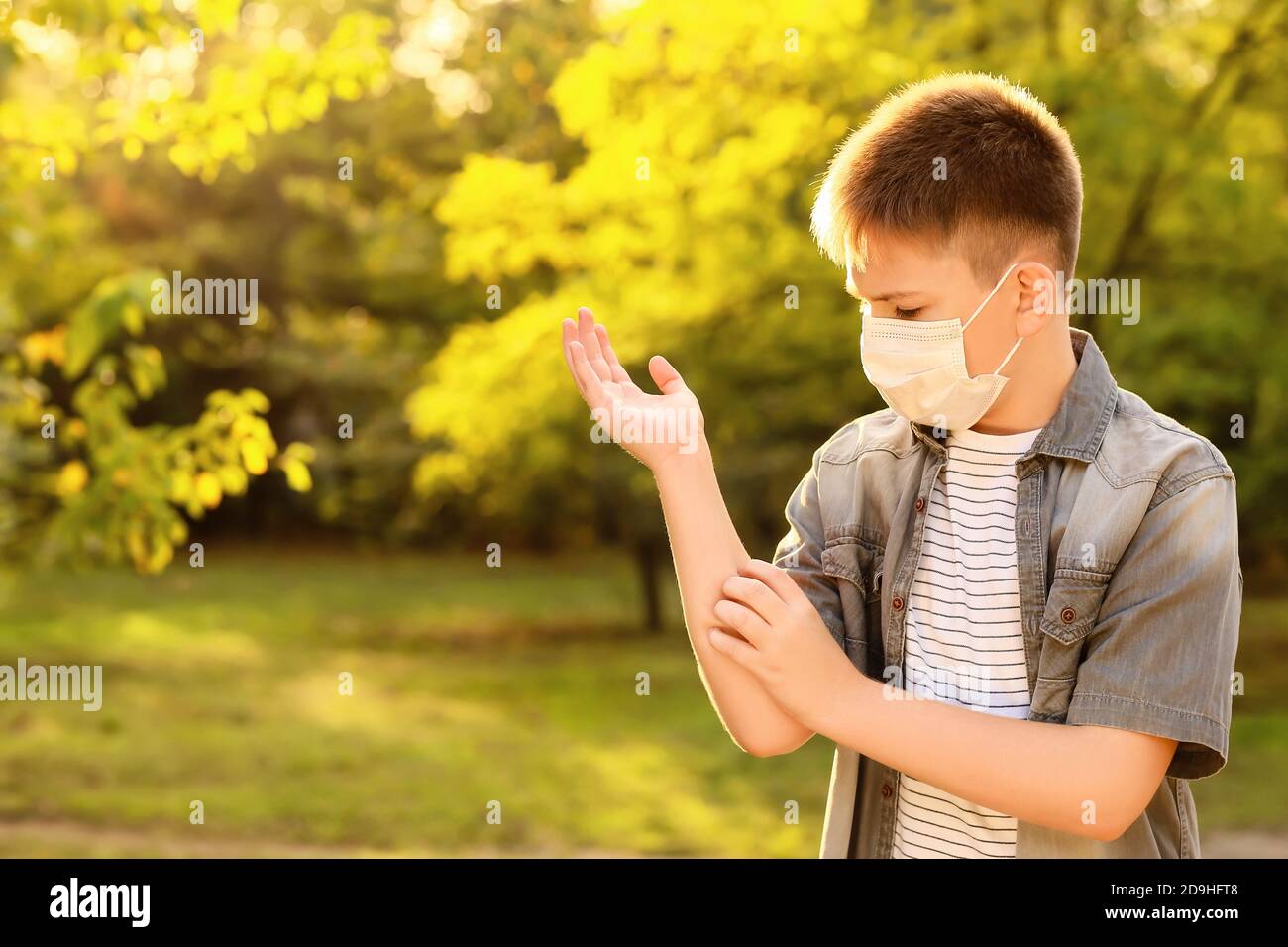 Allergic little boy scratching himself outdoors Stock Photo - Alamy