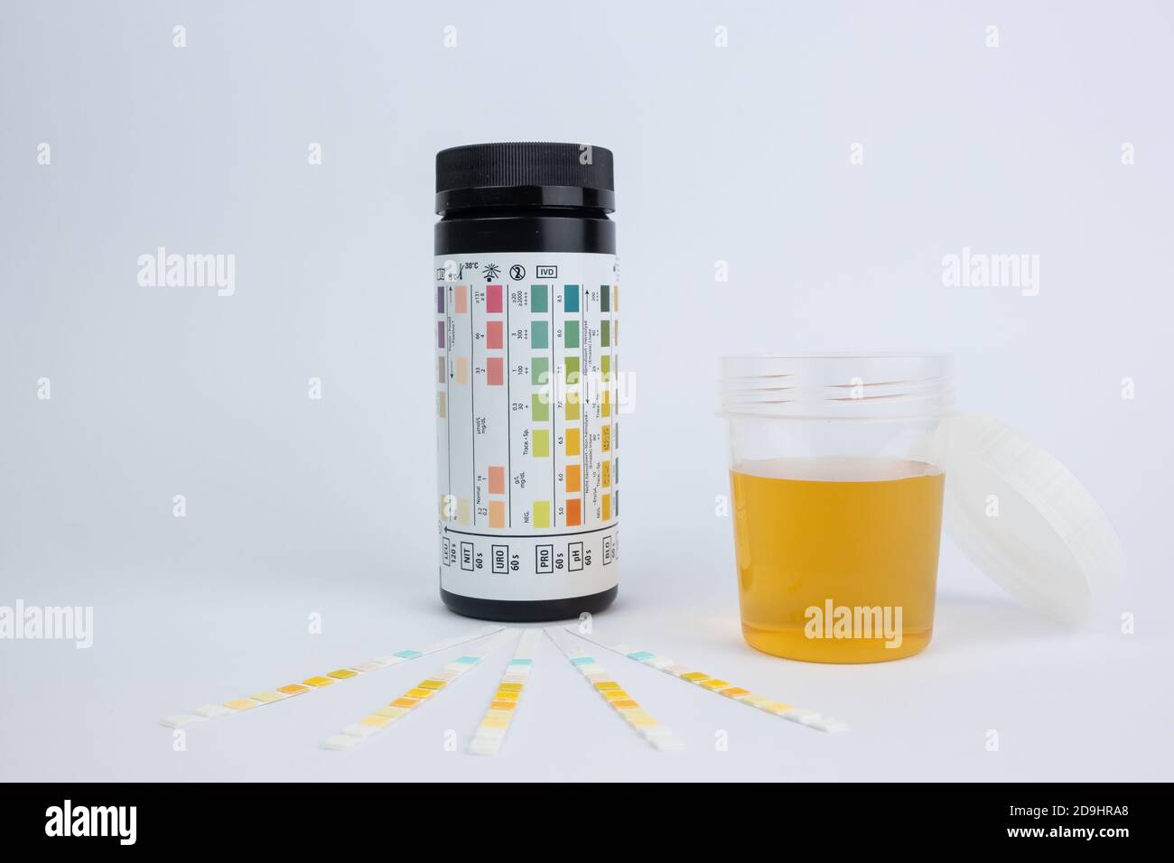 Closeup shot of test strips and a cup for urinalysis Stock Photo - Alamy