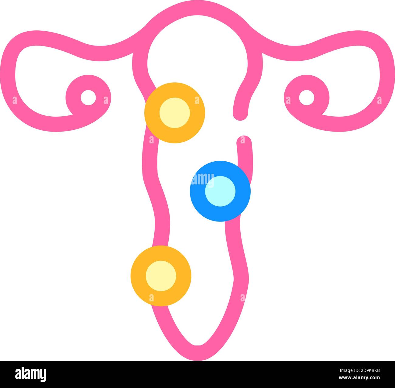 pathology of cervix color icon vector illustration Stock Vector Image ...