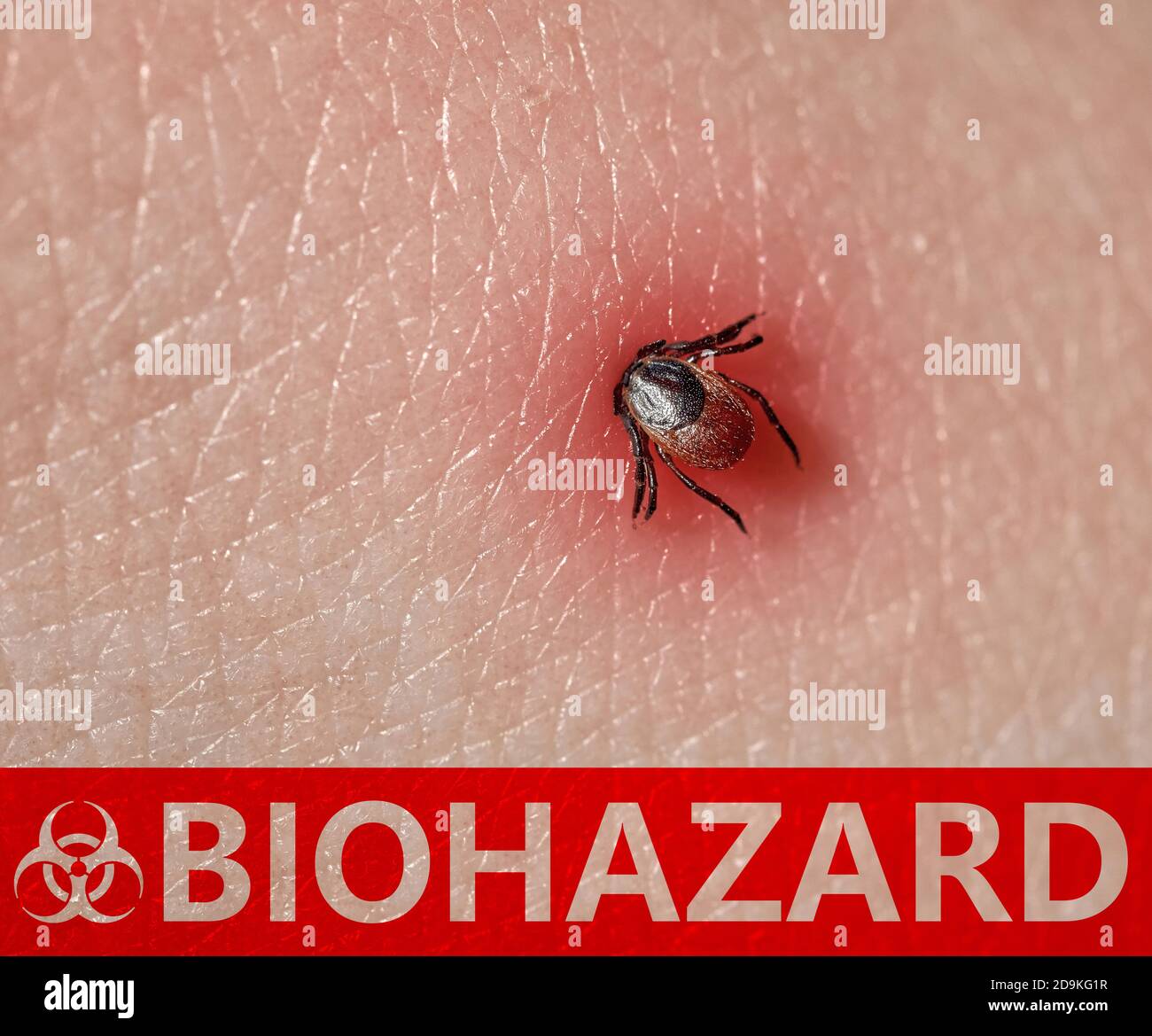 Deer Mites On Humans