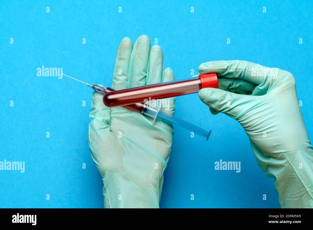lab technician assistant or doctor holding a blood sample in test tube ...