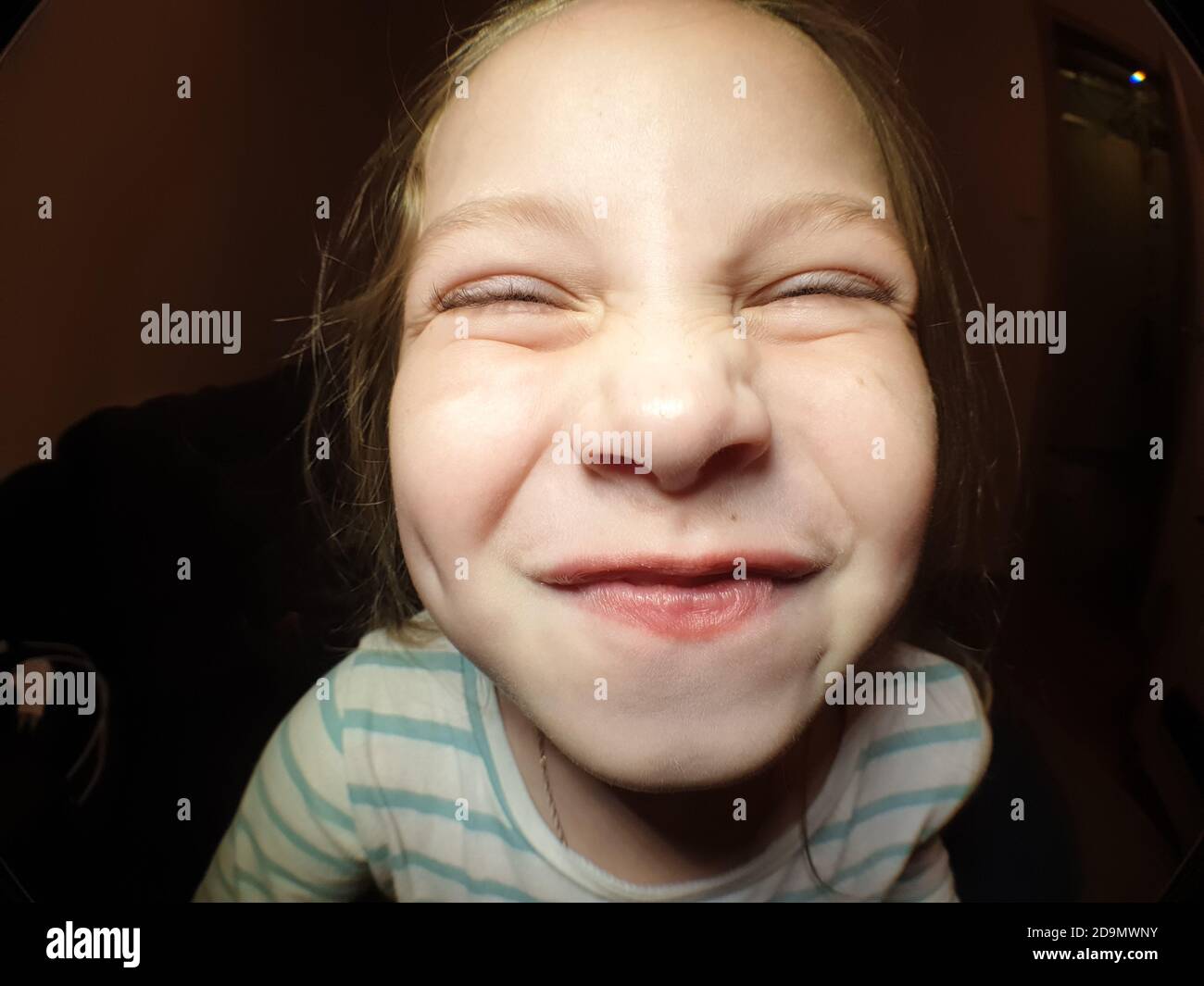 Deformity face hi-res stock photography and images - Alamy