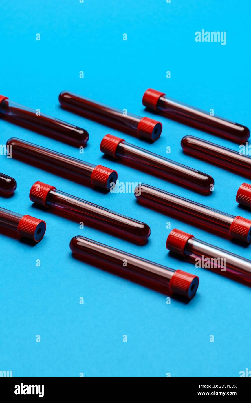 top view of medicine test tubes with blood samples over blue background ...