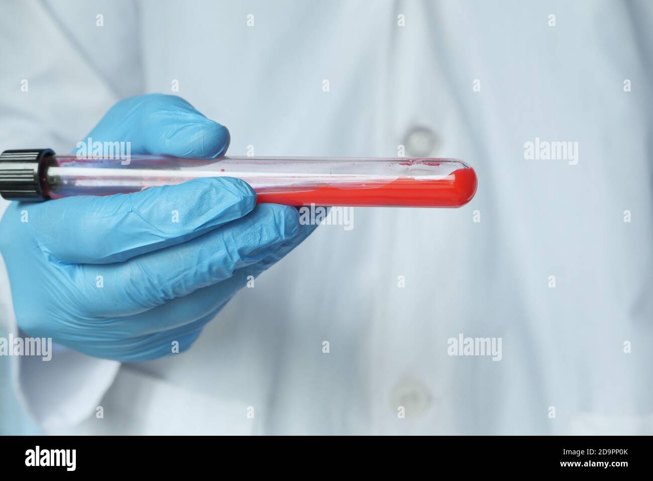 laboratory technician hand holding blood test tube Stock Photo - Alamy