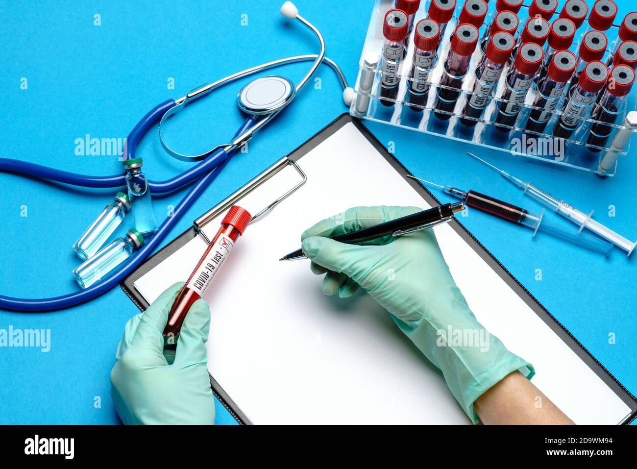 lab technician assistant or doctor holding a blood sample in test tube ...