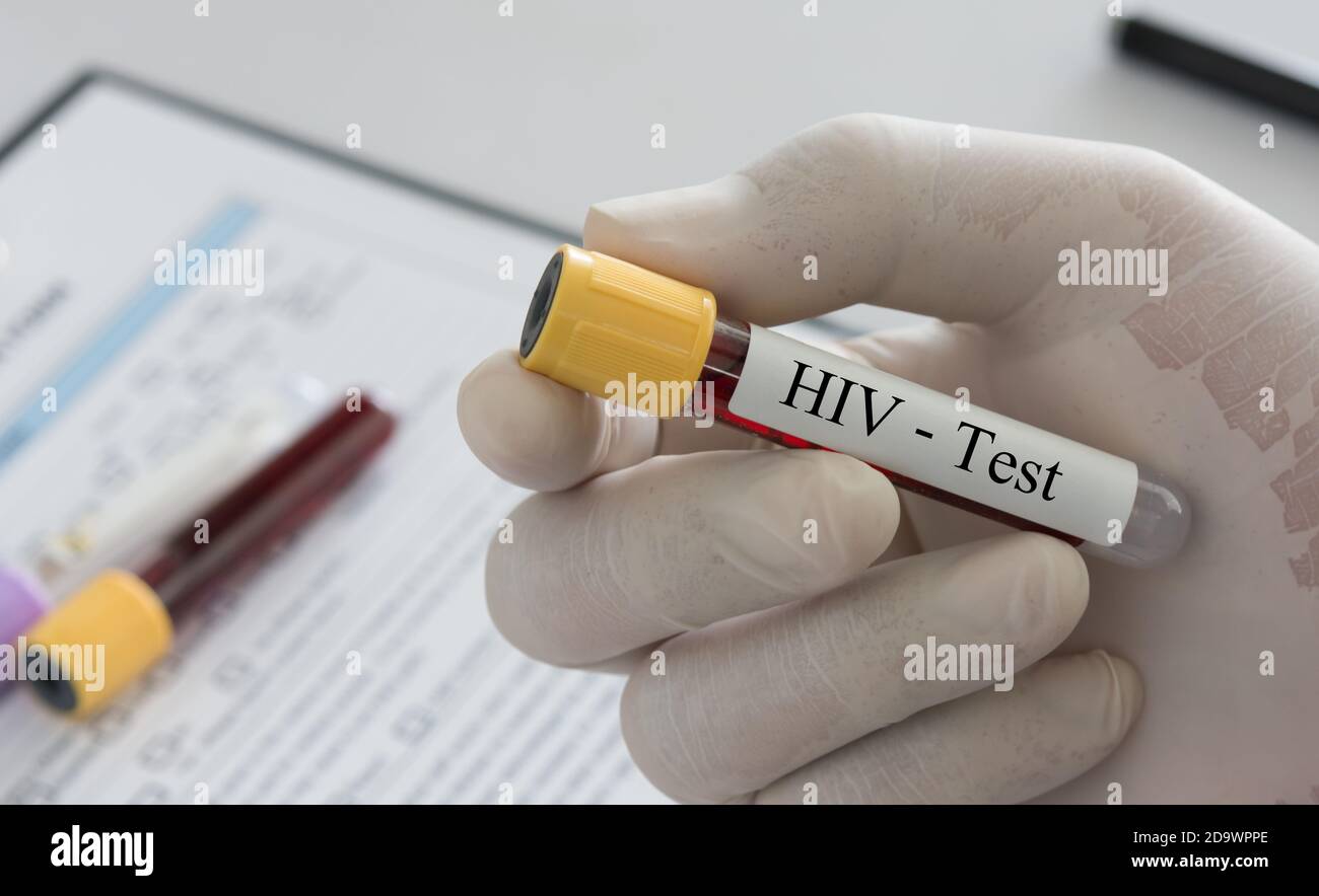 Doctor holding sample blood collection tube with HIV test label in lab ...