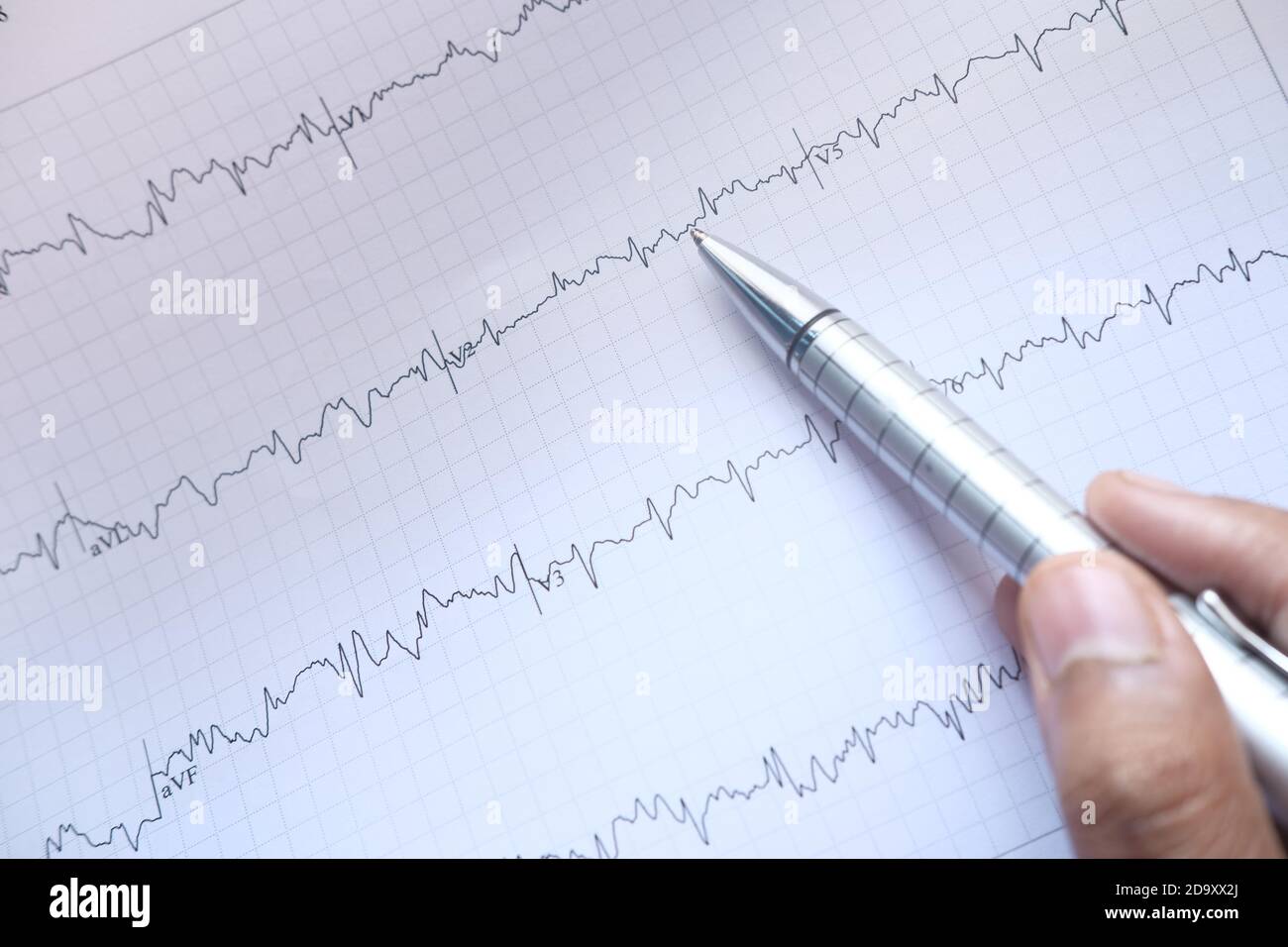 doctor hand analyzing cardio diagram close up Stock Photo - Alamy