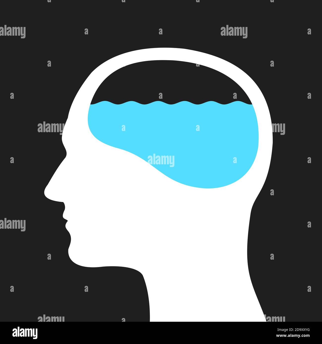 Hydrocephalus - water and fluid liquid in the silhouette of head. Brain ...