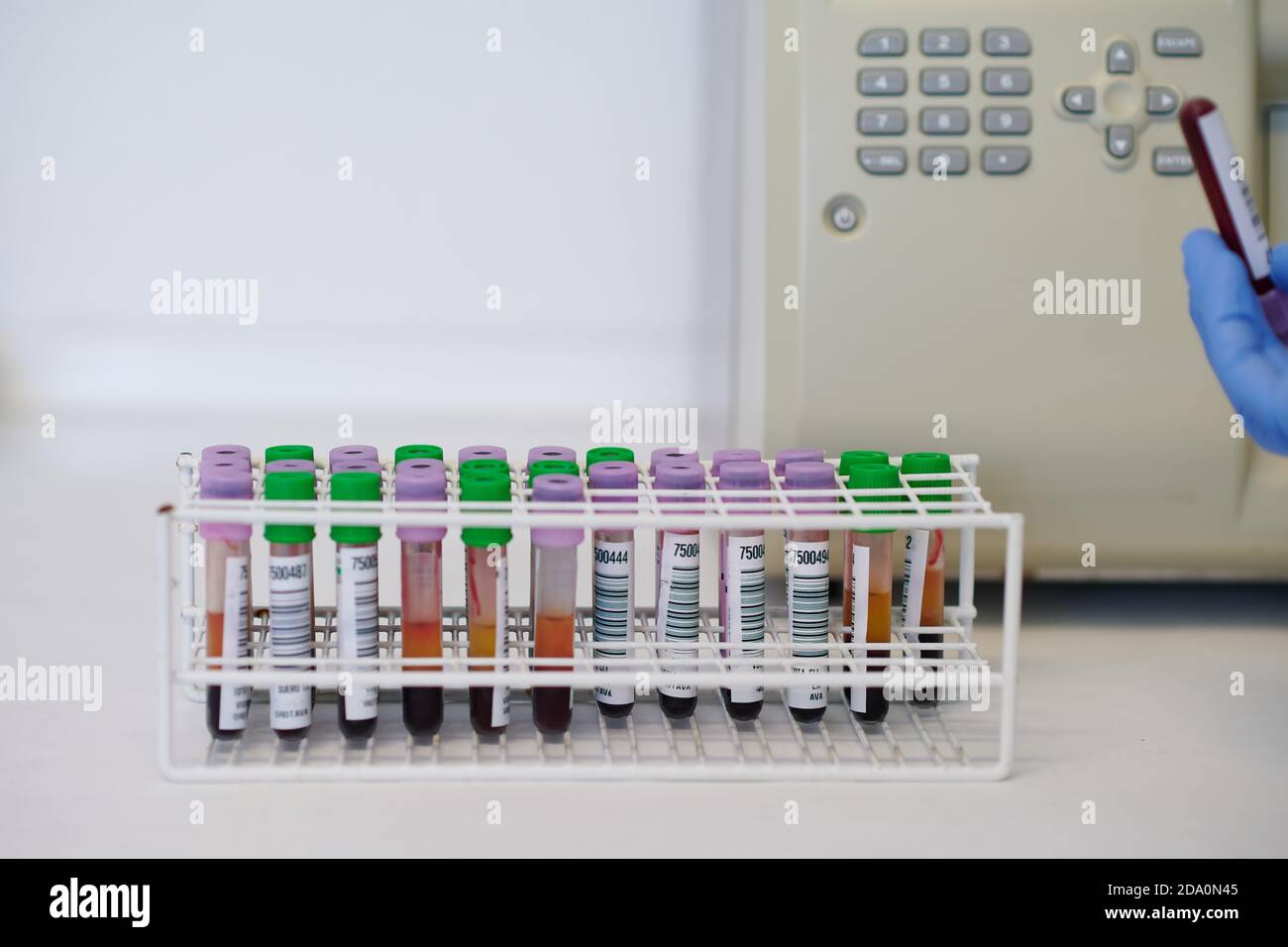 Blood analyzer hi-res stock photography and images - Alamy