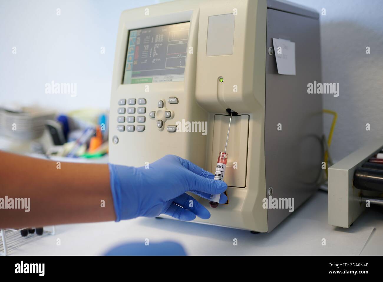 Hematology analyzer hi-res stock photography and images - Alamy
