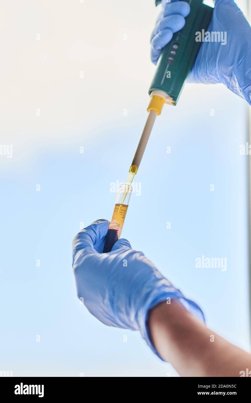 Crop anonymous medical specialist filling sample tube with blood while ...