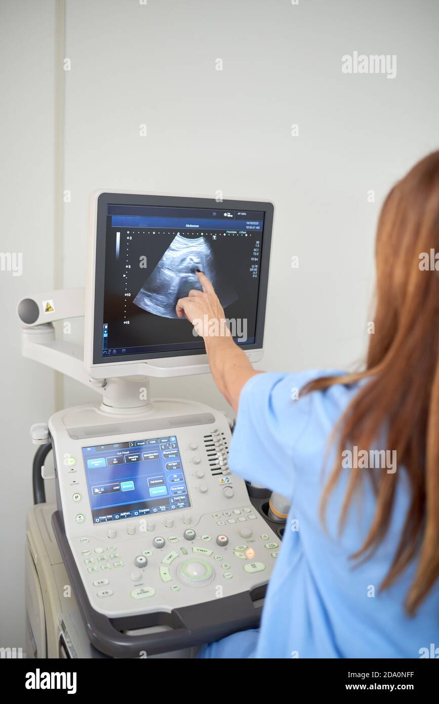 Back view of crop unrecognizable doctor showing video on ultrasound ...