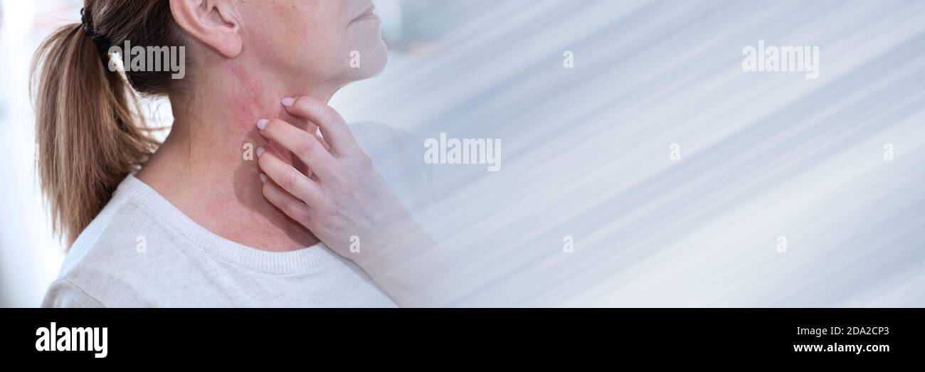 Woman having itchy and scratching her neck. allergy symptoms; panoramic banner Stock Photo - Alamy