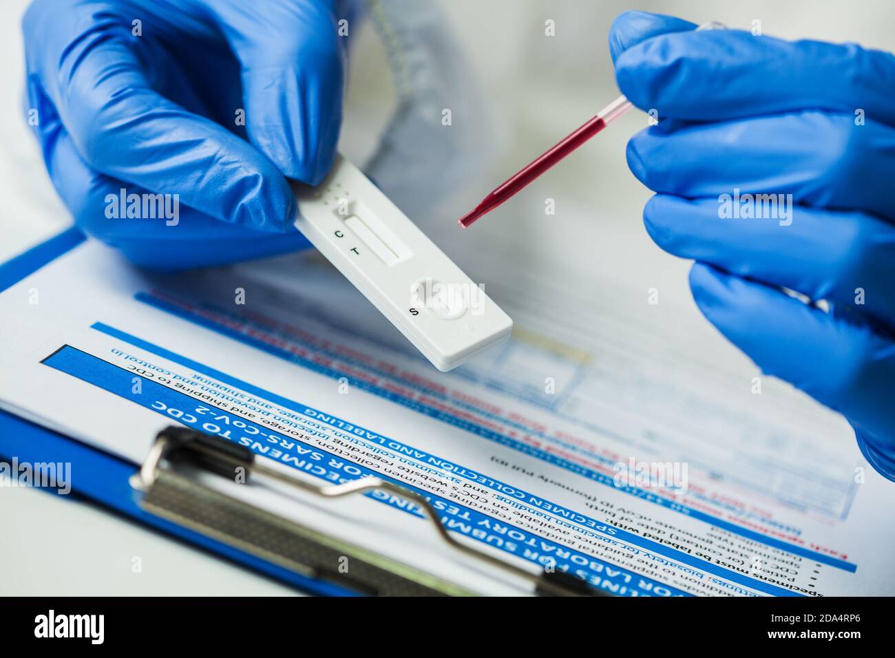 Viral serology hi-res stock photography and images - Alamy