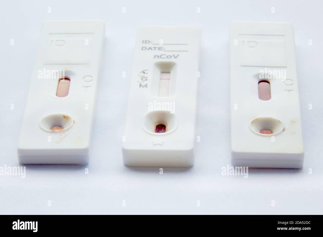 Blood drop test tube hi-res stock photography and images - Alamy