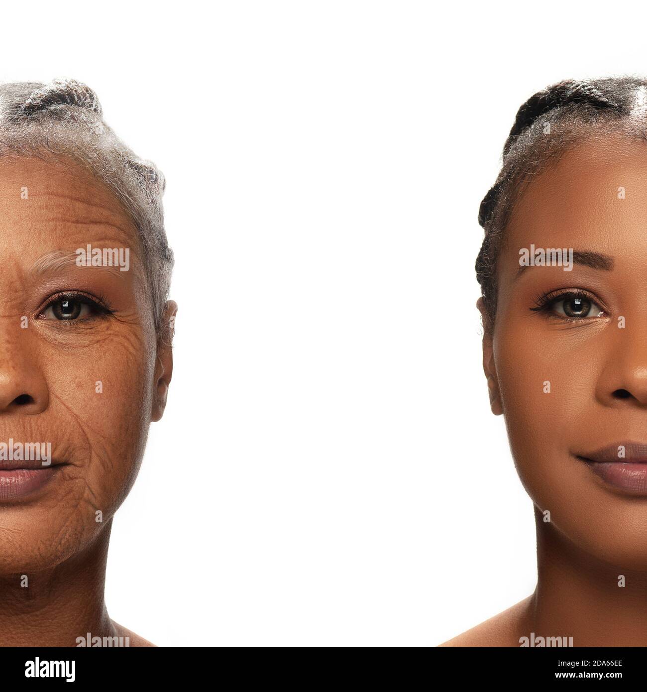 Comparison. Portrait of beautiful african woman with problem and clean ...