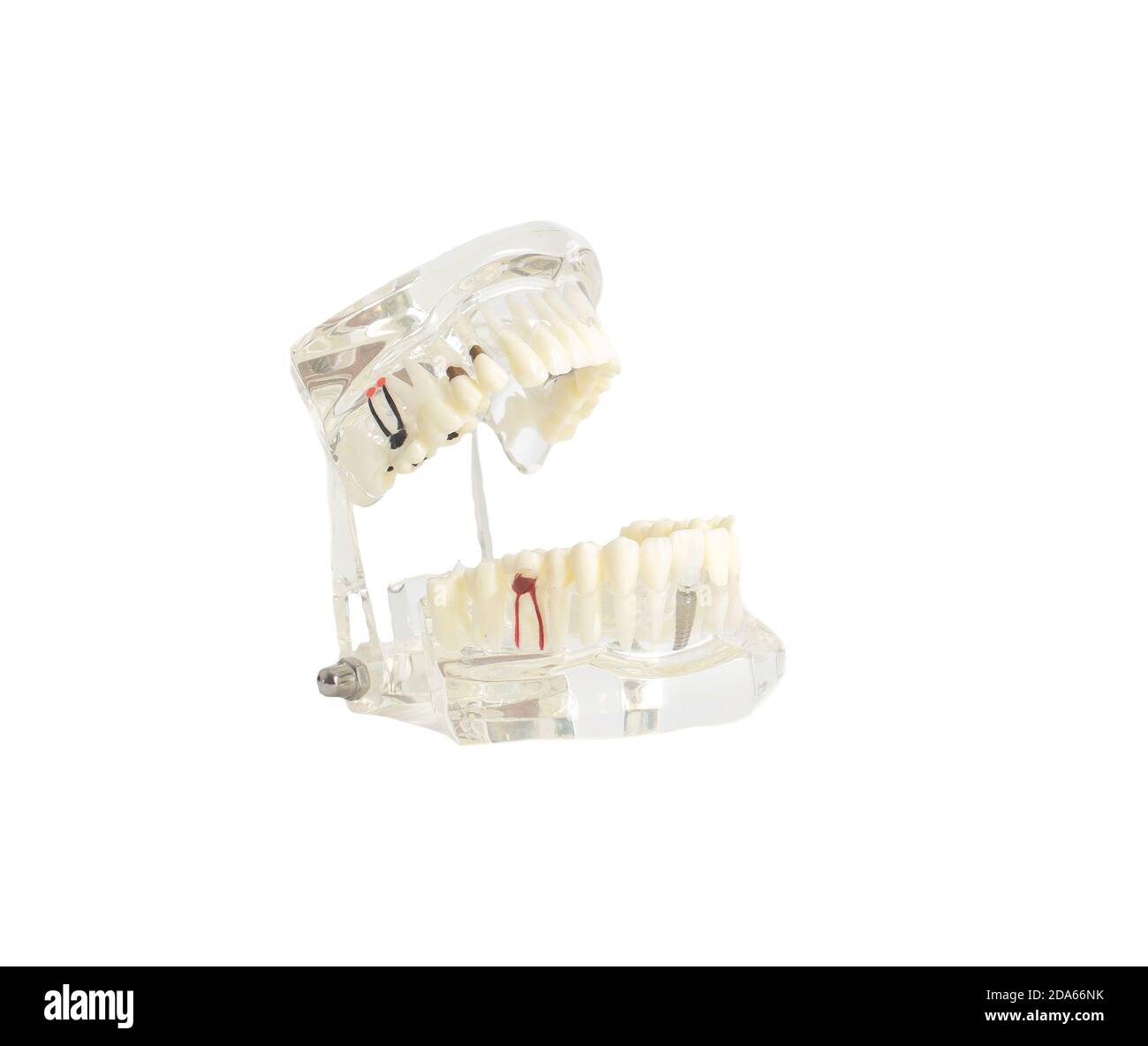 model of a dental jaw on a white background, isolate. Dentistry Stock ...