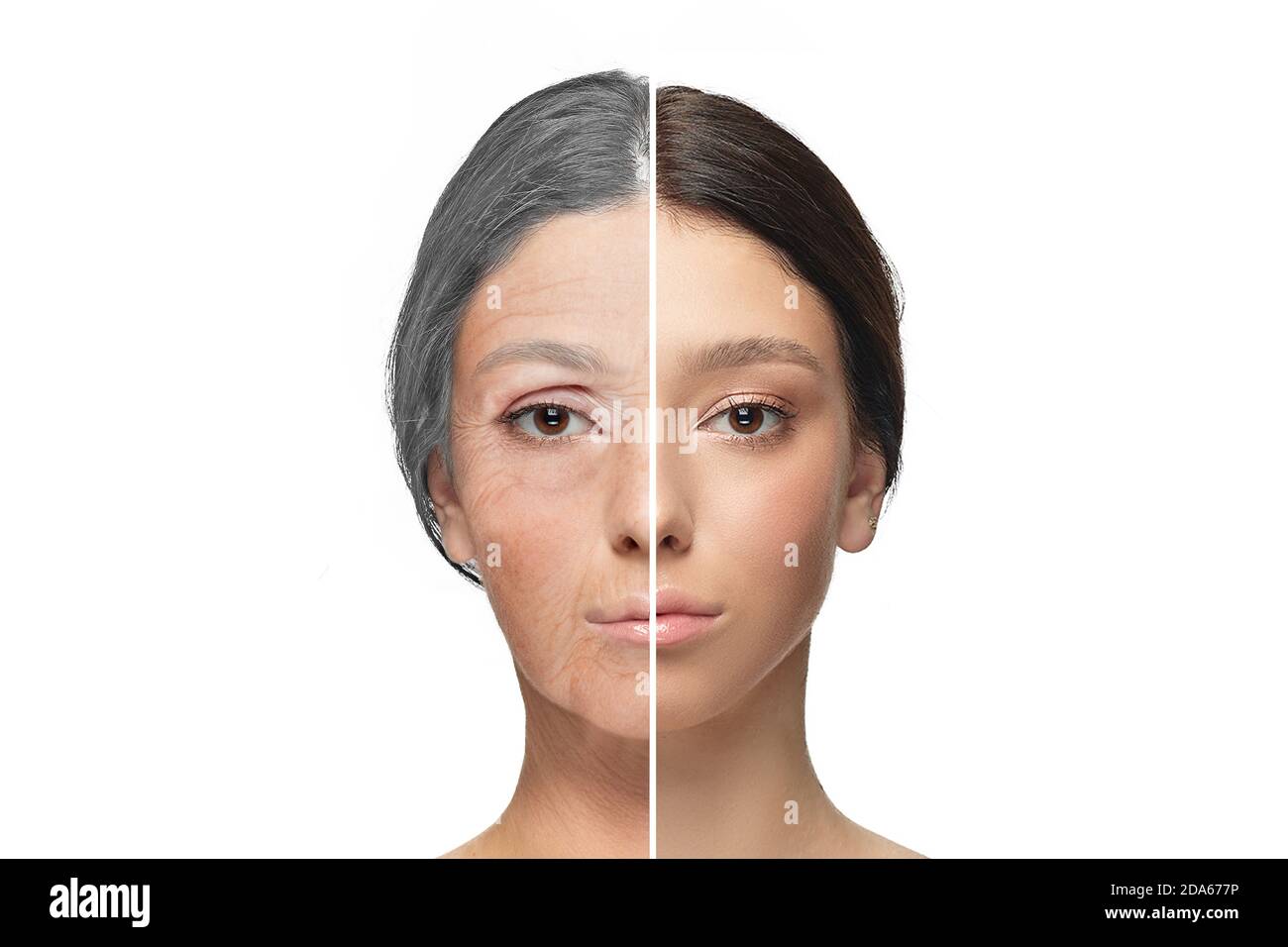 Comparison. Portrait of beautiful woman with problem and clean skin ...