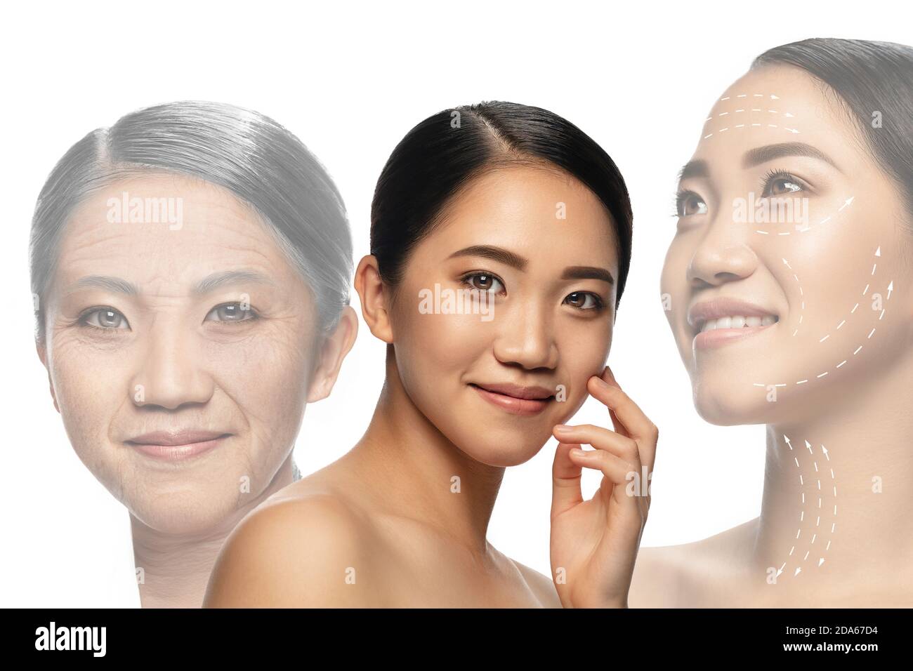 Comparison. Portrait of beautiful asian woman with problem and clean ...