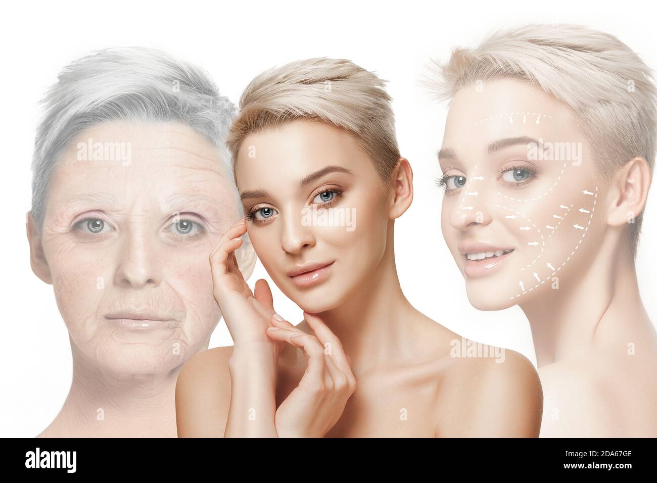 Comparison. Portrait of beautiful woman with problem and clean skin ...