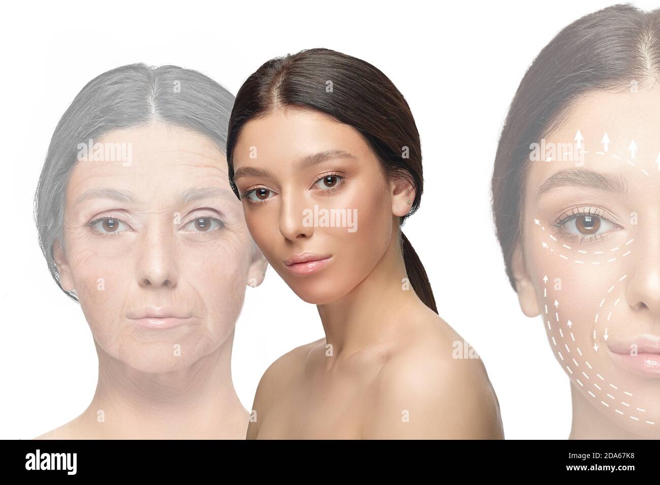 Comparison. Portrait of beautiful woman with problem and clean skin ...