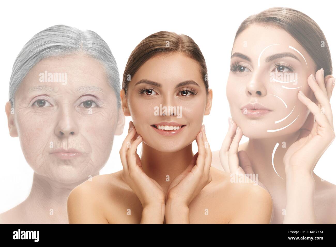 Comparison. Portrait of beautiful woman with problem and clean skin ...