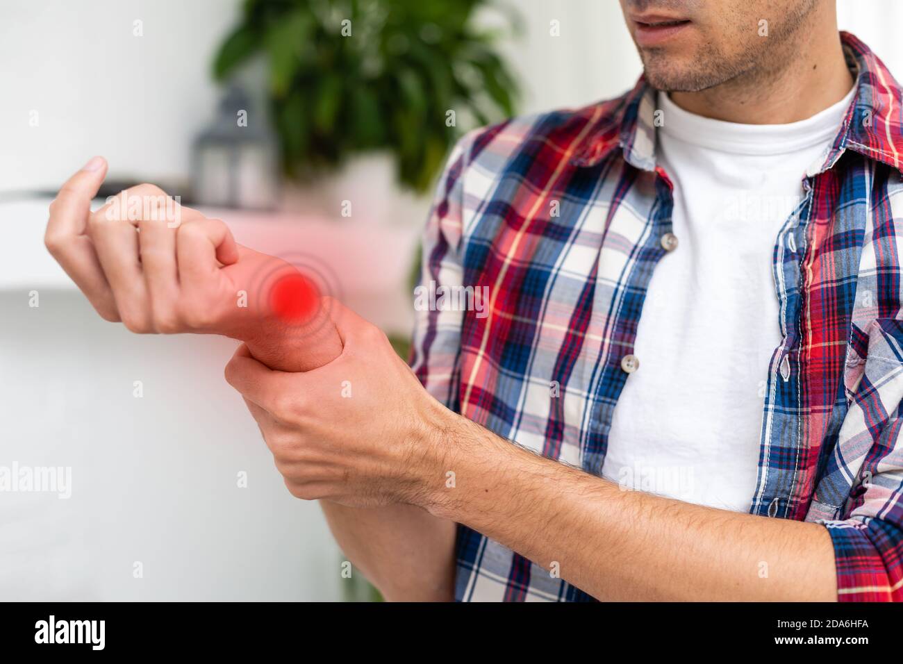 man holds a sore hand glows red Stock Photo - Alamy