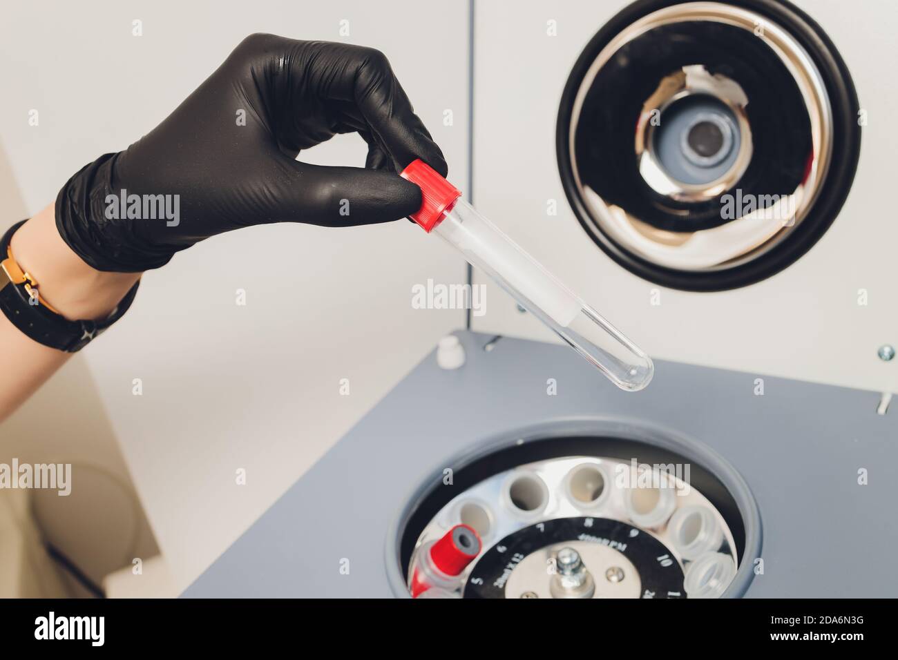 Platelet-Rich plasma preparation. Tube with blood in hands. Centrifuge ...