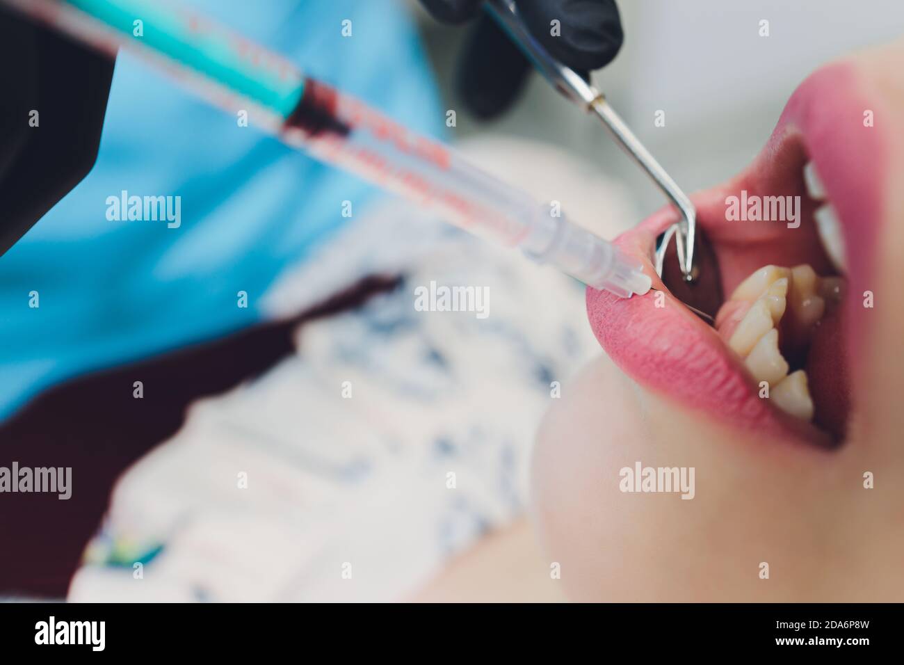 Dentist giving injection for anesthetizing his patient Stock Photo - Alamy